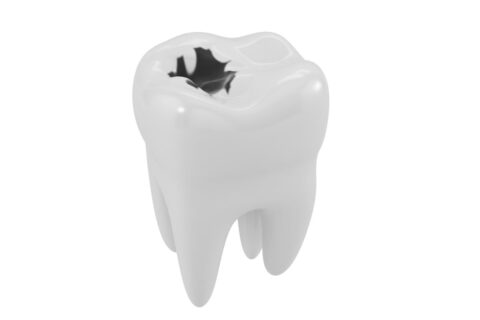 Tooth Turning Black: What are the causes and How to Prevent
